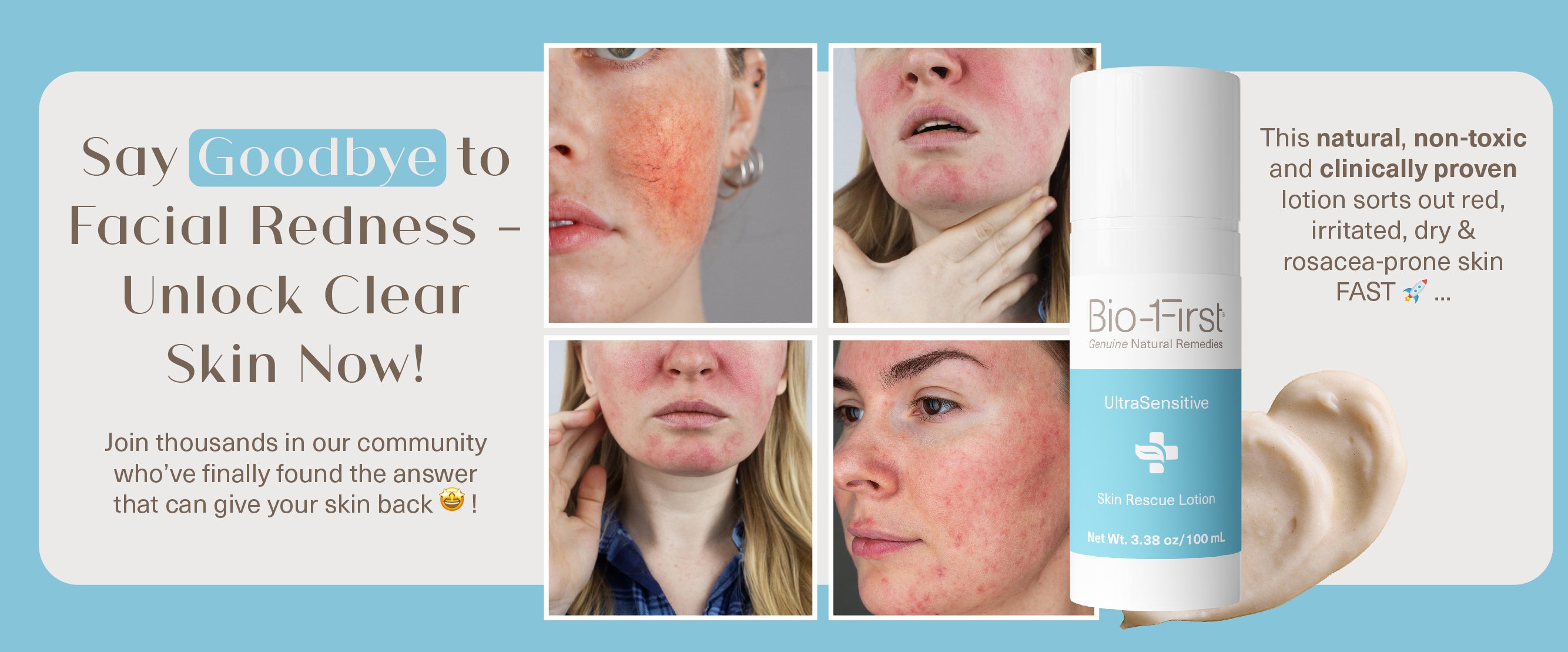 UltraSensitive Skin Rescue Lotion | Natural Moisturiser for Rosacea-Prone Skin – Bio-First