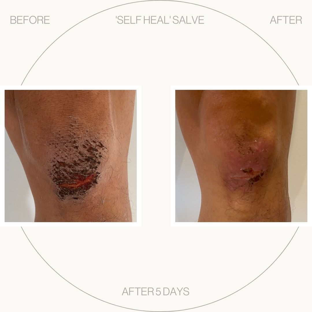 First Aid – Bio-First