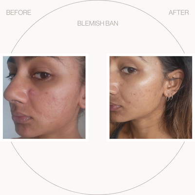 Bio-First | Natural, Non-Toxic Skin Health Solutions